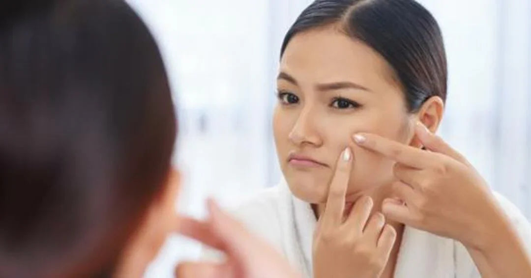 Newsweek: The Dangers of Popping a Pimple in the 'Triangle of Death ...