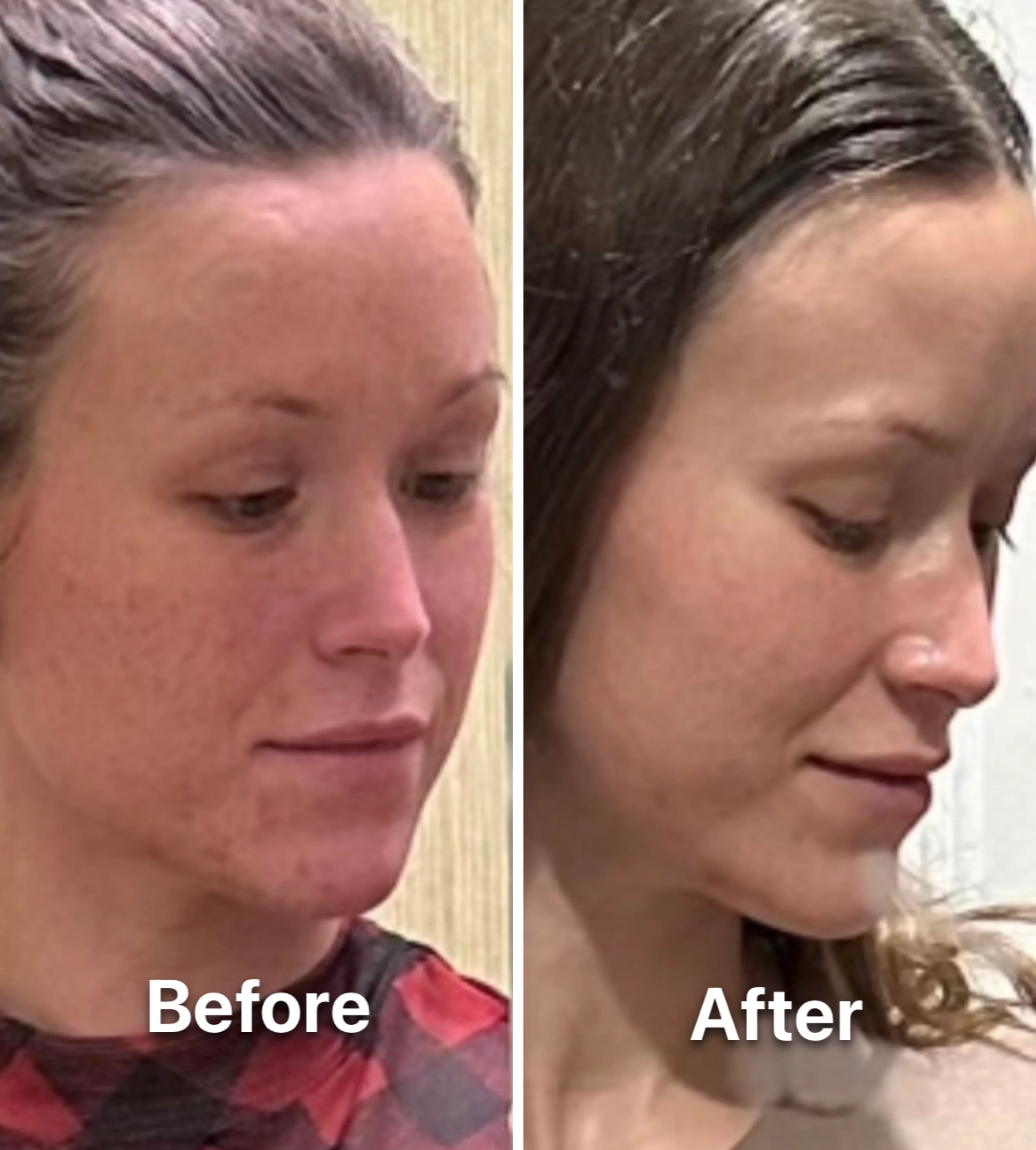 Before and After Special – ästhetik skincare